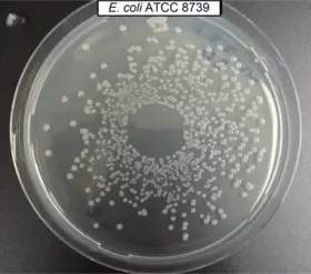 Escherichia coli (Migula) Castellani and Chalmers (each) ATCC in ...